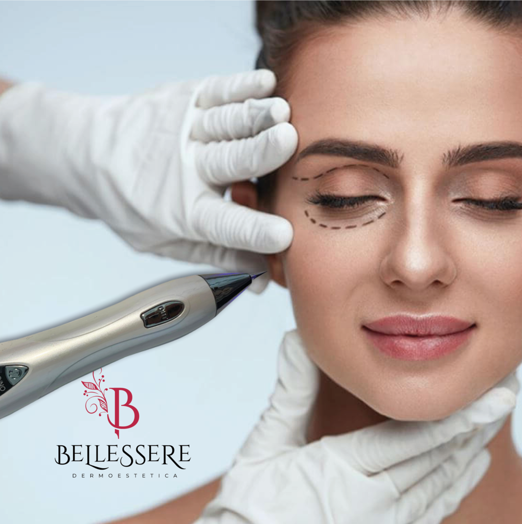 Curso PlasmaPen - Comprar en Biodepot