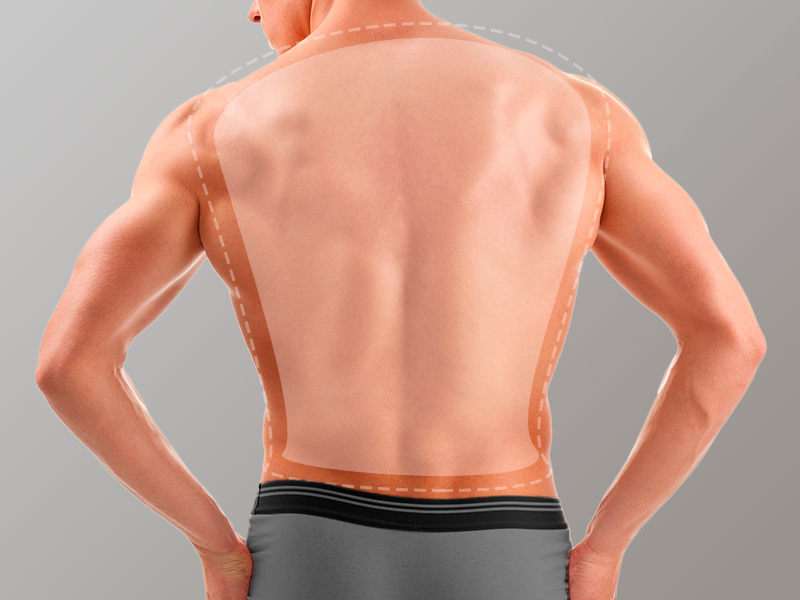 Costas Masculinas - Pacote Completo - Dr. Laser