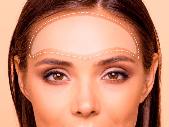 Testa Feminina - Pacote Completo - Comprar em Dr. Laser