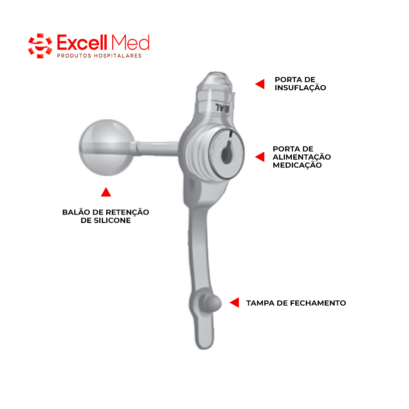 sonda de gastrostomia