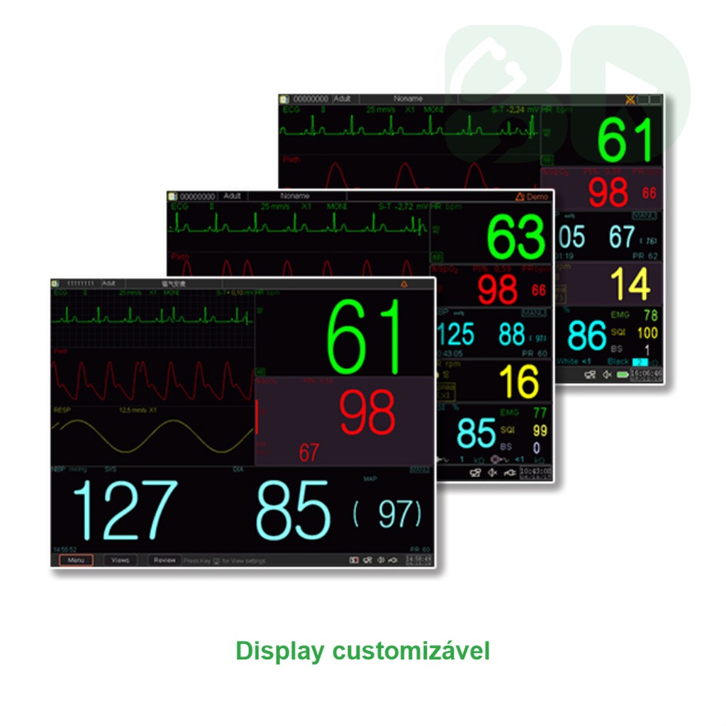 Monitor Multiparamétrico K15 - Creative